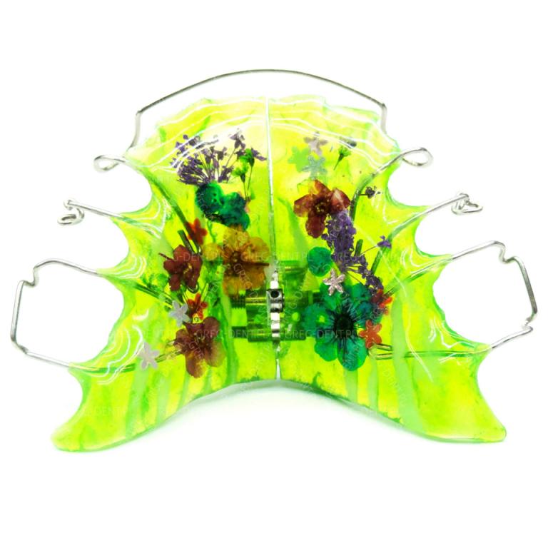 Aparaty jednoszczękowe - GREG-DENT ORTHODONTICS SP. Z O.O.