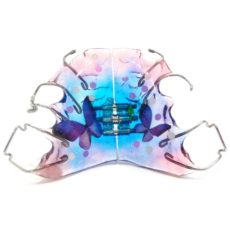 Aparaty jednoszczękowe - GREG-DENT ORTHODONTICS SP. Z O.O.